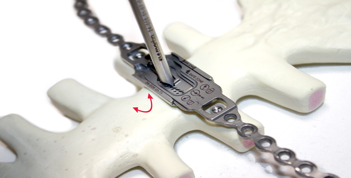 KLS Martin | Recon Talon