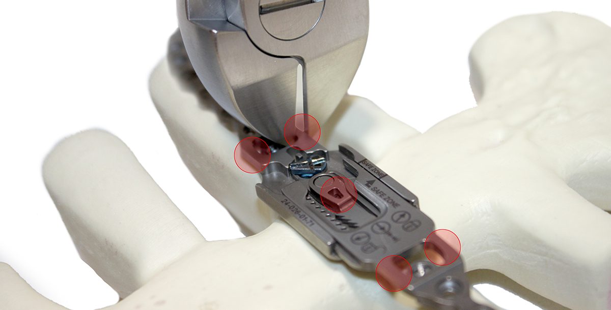 KLS Martin | Recon Talon