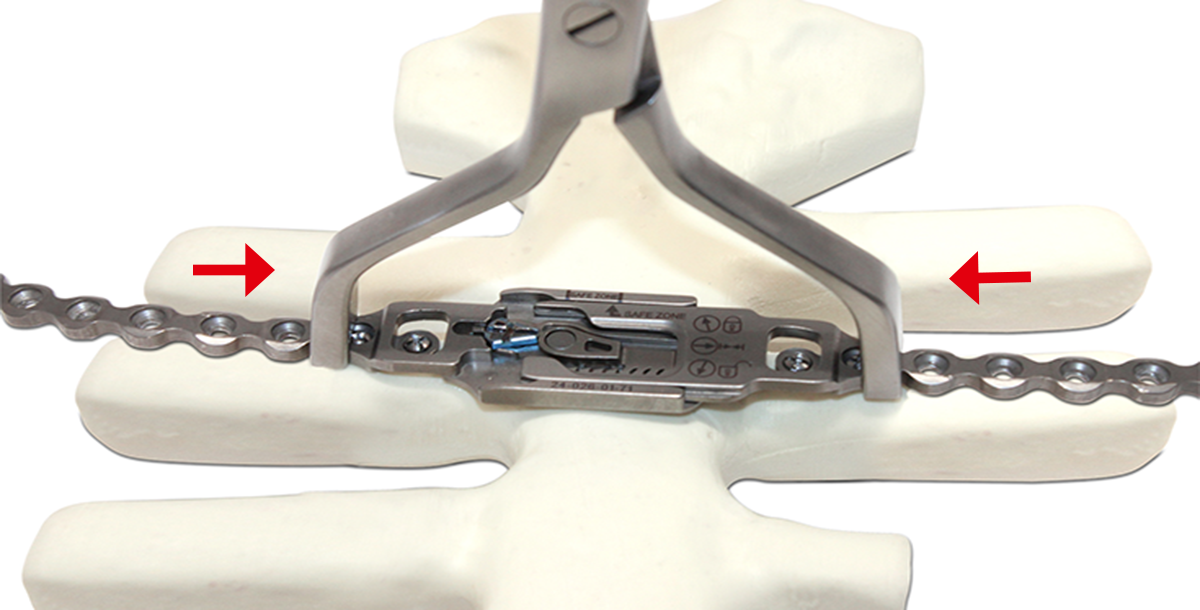 KLS Martin | Recon Talon