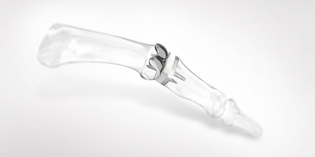 KLS Martin | Implant knowledge Hand