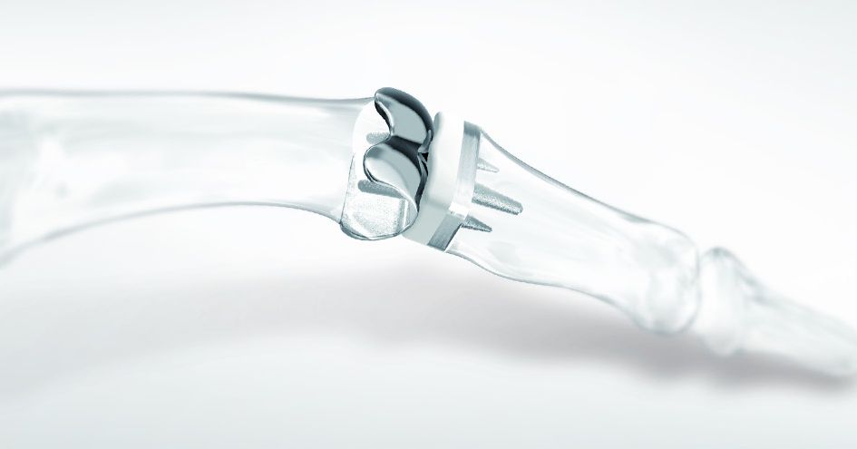 KLS Martin | Hand surgery | Endoprosthetics