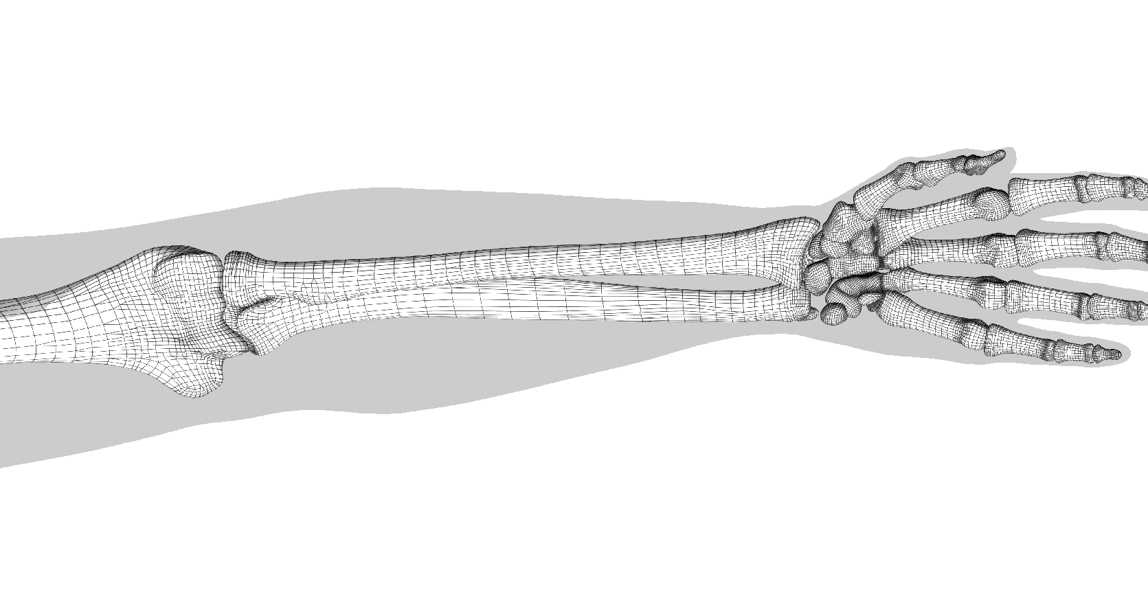 KLS Martin | FAQ - Frequently asked questions about IPS Gate®