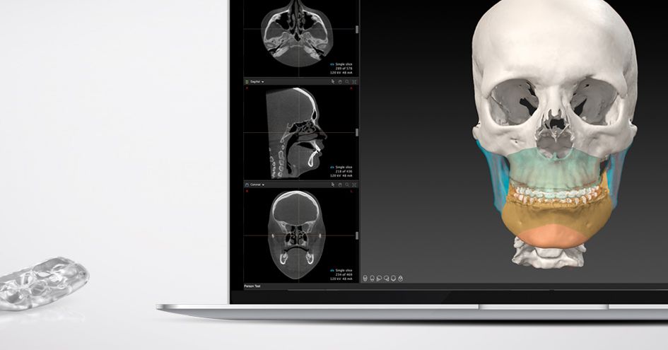 KLS Martin | Planificación tridimensional virtual con IPS CaseDesigner®