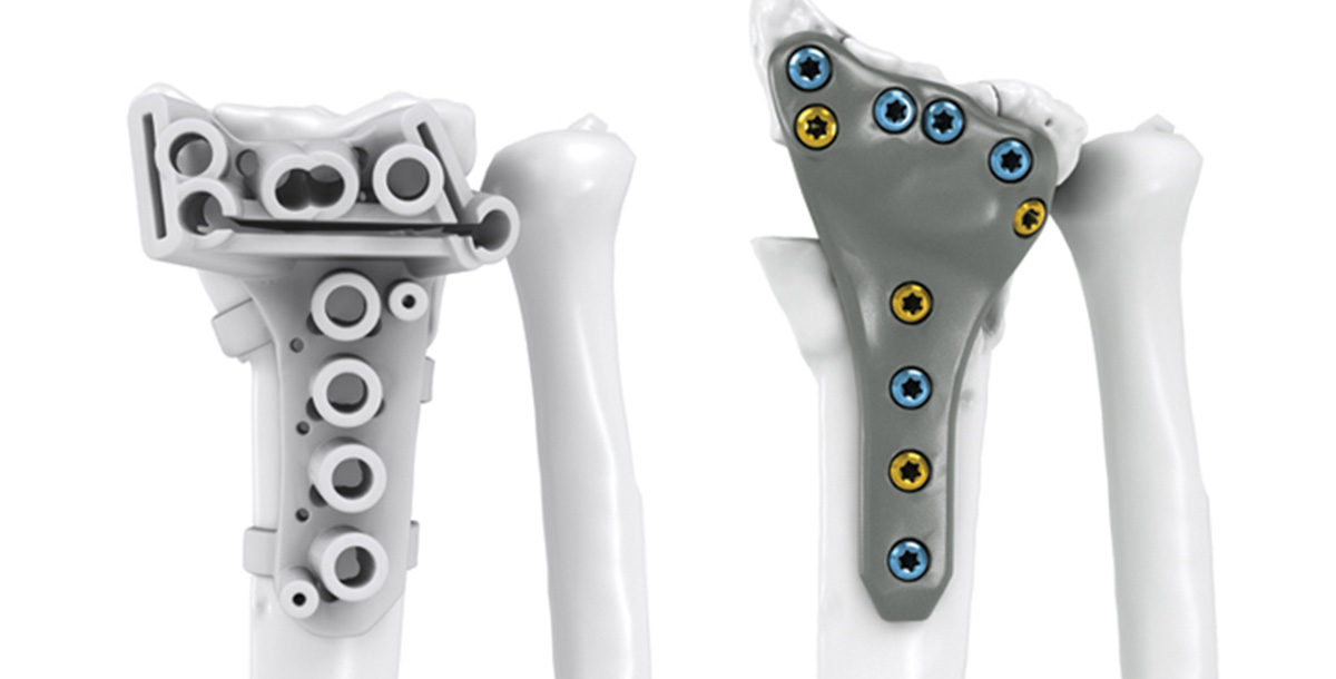 KLS Martin | Ausbildung, Duales Studium und mehr bei KLS Martin