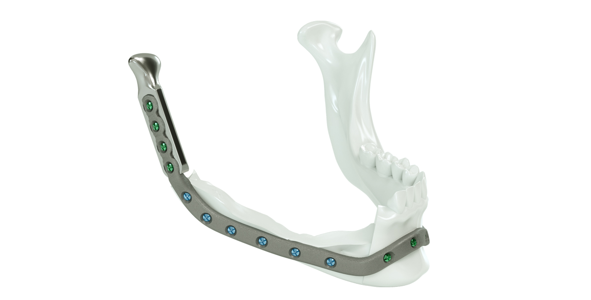 KLS Martin | IPS Implants® Mandible Reconstruction