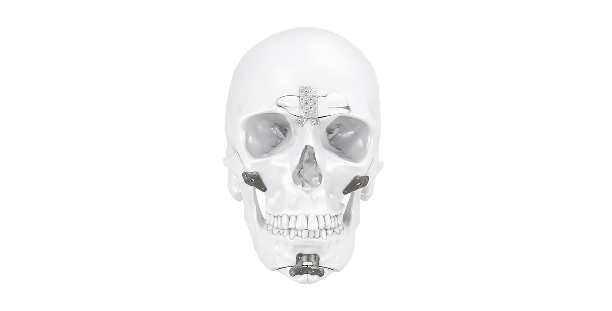 KLS Martin | IPS Implants® Transformation