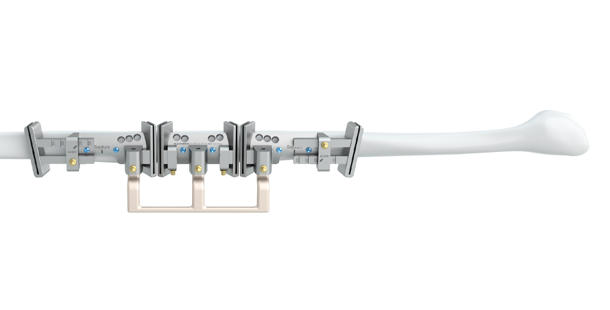 KLS Martin | L1® Mandible ReconGuide