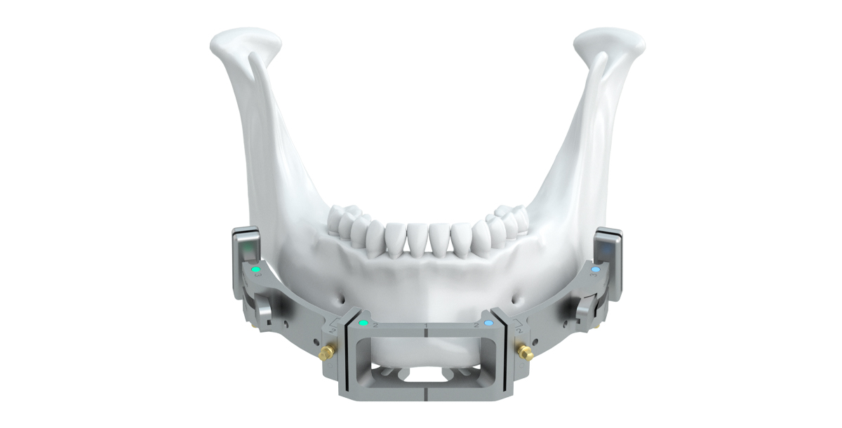 KLS Martin | L1® Mandible ReconGuide