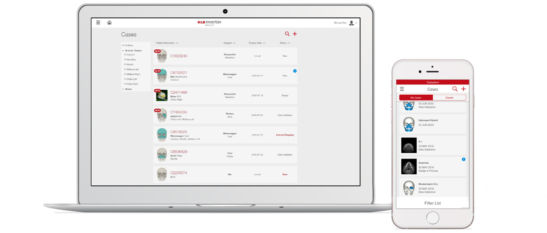 IPS Gate® - KLS Martin